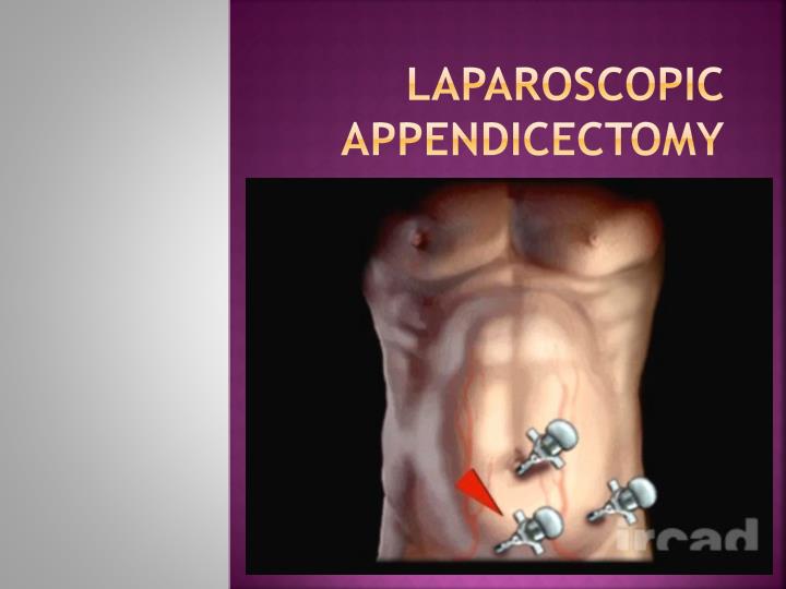 PPT - Appendicectomy PowerPoint Presentation - ID:3112134