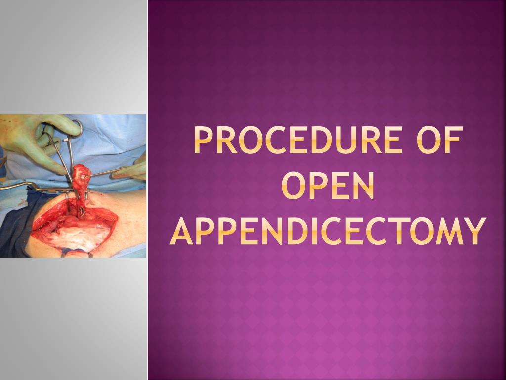 Ppt Appendicectomy Powerpoint Presentation Free Download Id 3112134