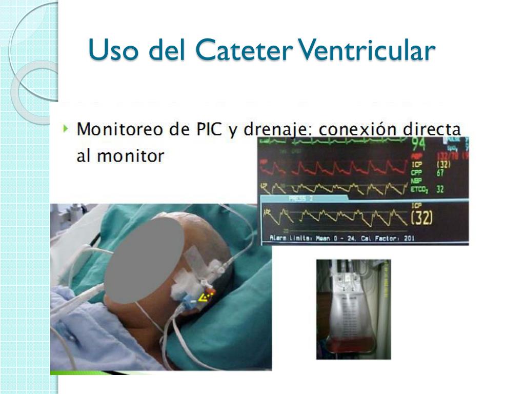PPT - Lic. Esp . Marina Vega Lizarme Centro Médico Naval “CMST” Lima ...