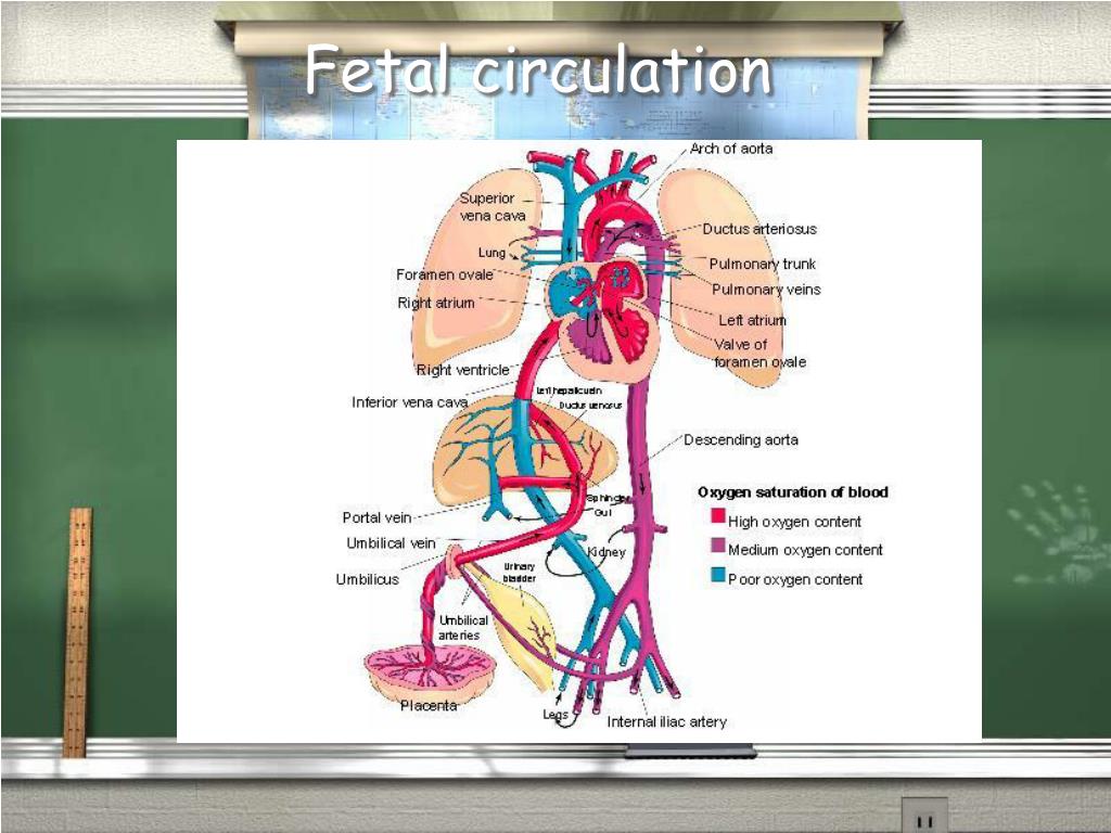 PPT - Delivery Room Management of Neonates with Single Ventricle ...
