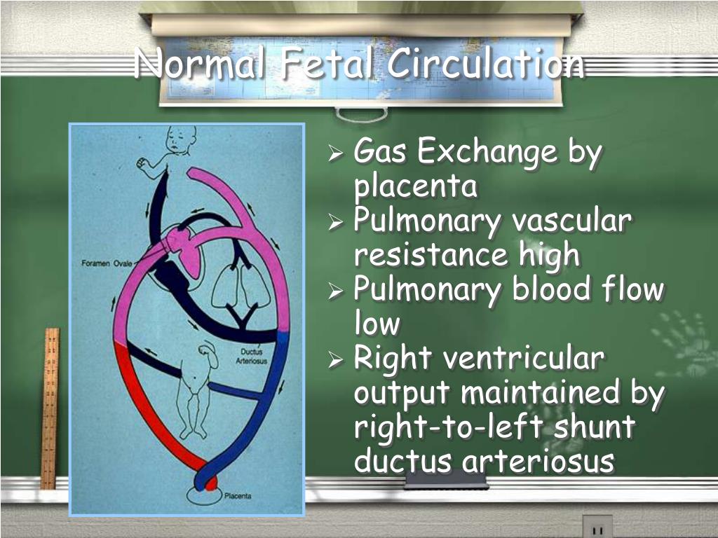 PPT - Delivery Room Management of Neonates with Single Ventricle ...