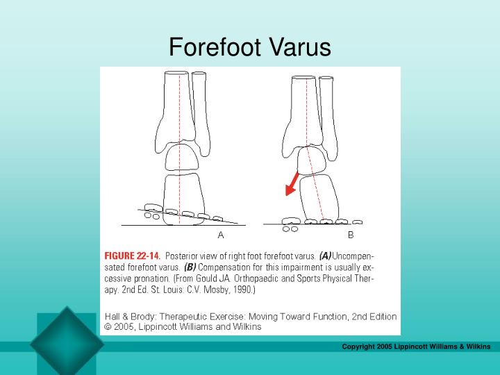 PPT - Chapter 22 The Ankle and Foot PowerPoint Presentation - ID:3114388