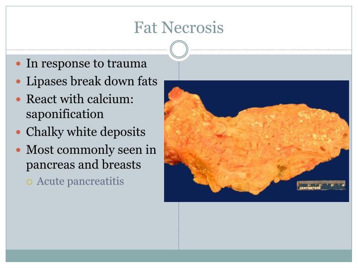 PPT - Necrosis PowerPoint Presentation - ID:3115052