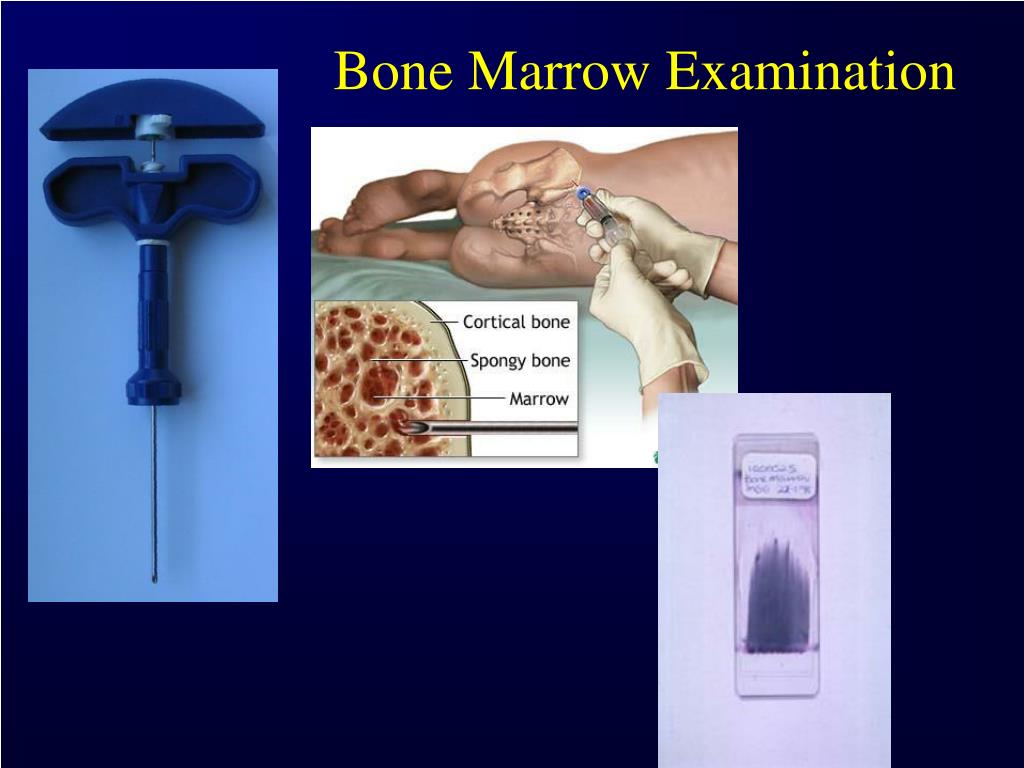 PPT - Senior Academic Half Day: Malignant Haematology PowerPoint ...