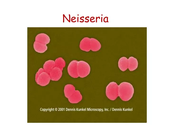 PPT - Neisseria PowerPoint Presentation, free download - ID:3121064