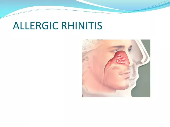 PPT - ALLERGIC RHINITIS PowerPoint Presentation, free download - ID:3122959