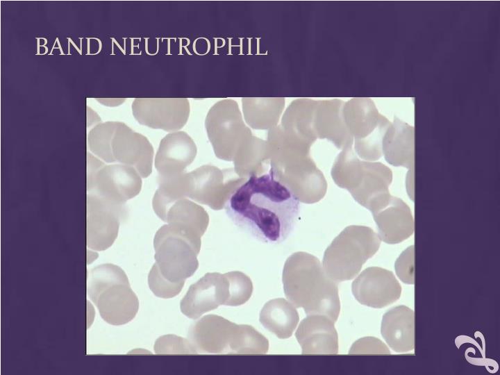 PPT - Blood smear examination PowerPoint Presentation - ID:3122984