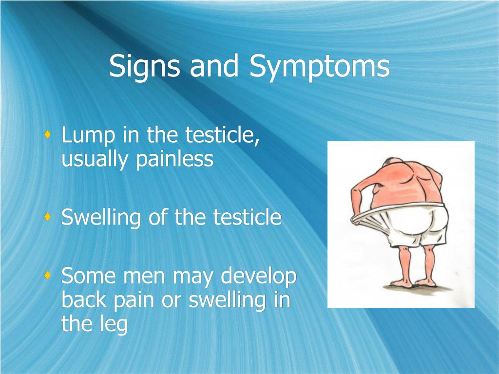 PPT - Female and Male Cancers PowerPoint Presentation, free download ...