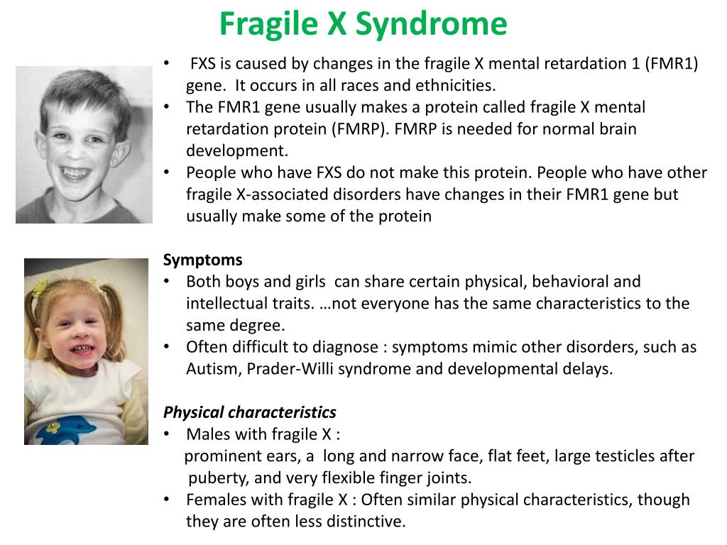 PPT - Common Causes of Intellectual Disabilities PowerPoint ... PPT - Common Causes of Intellectual Disabilities PowerPoint ...