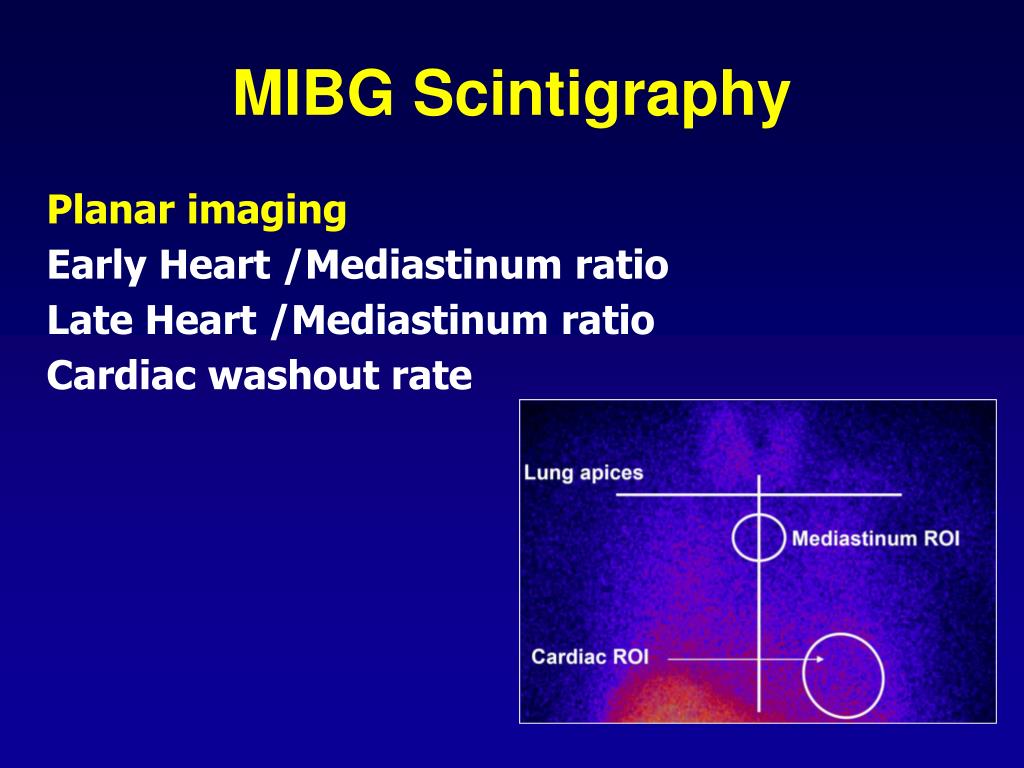 PPT - RISK STRATIFICATION IN HEART FAILURE ROLE OF CARDIAC I-123- MIBG ...