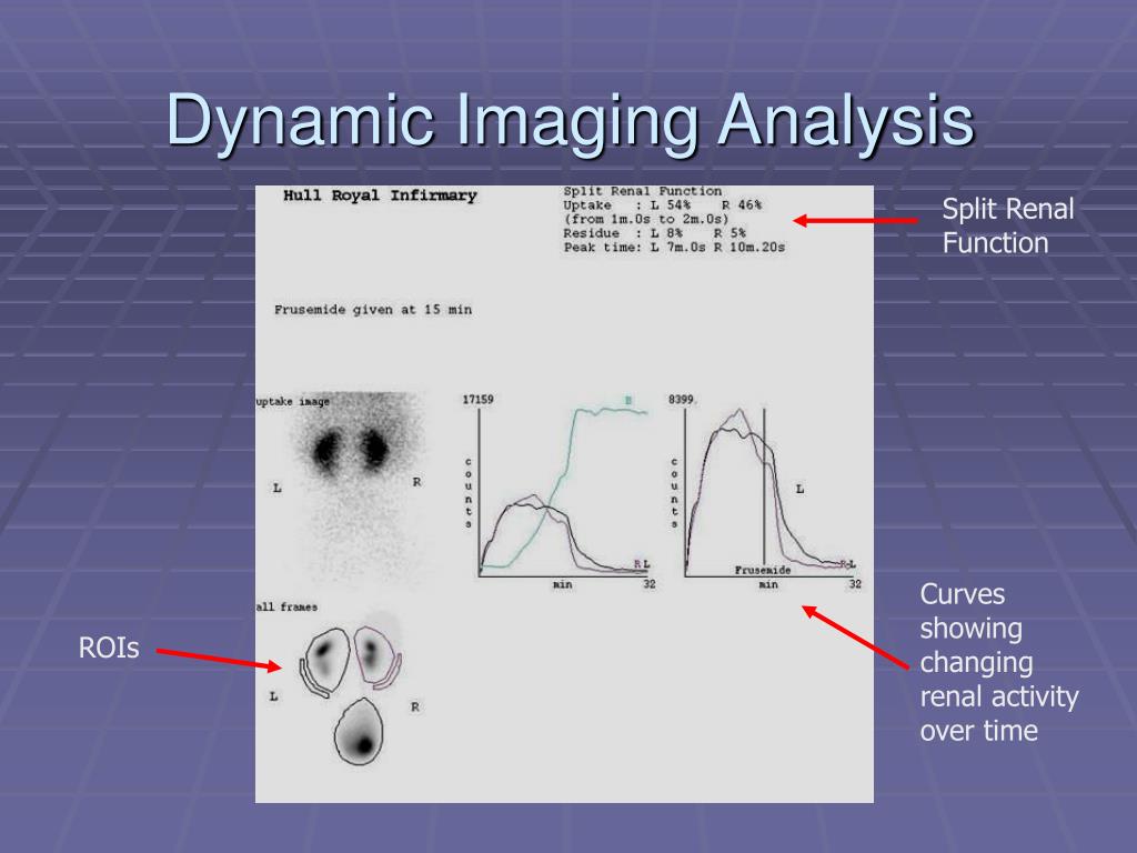PPT - Nuclear Medicine: Planar Imaging and the Gamma Camera PowerPoint ...