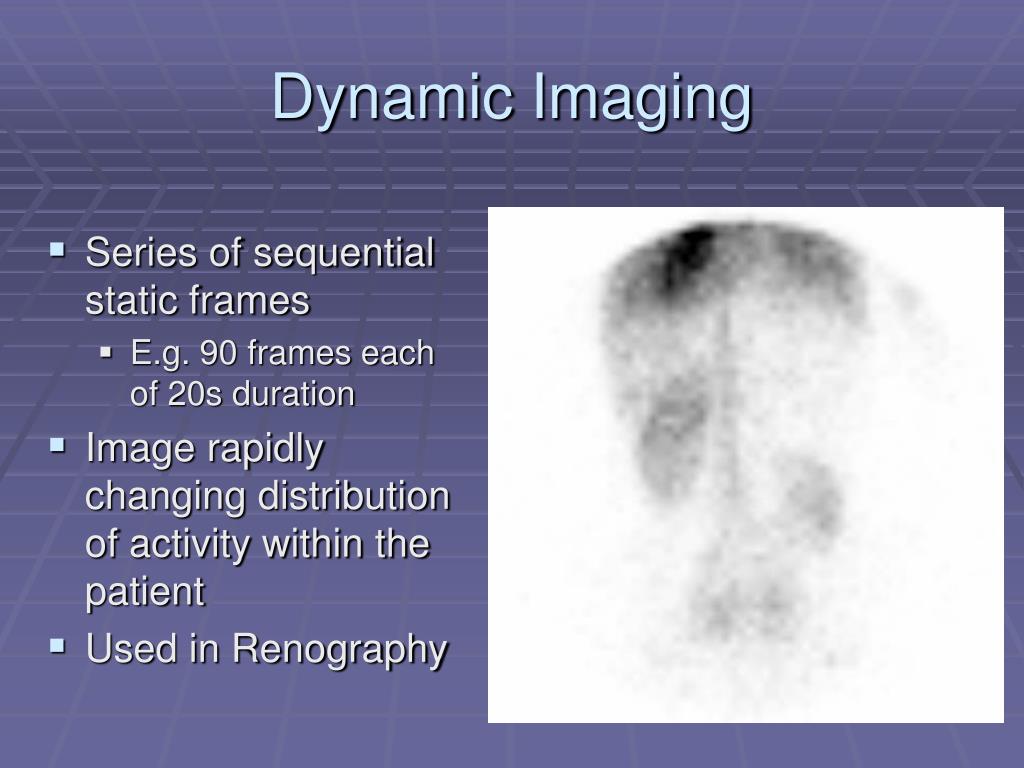 PPT - Nuclear Medicine: Planar Imaging and the Gamma Camera PowerPoint ...