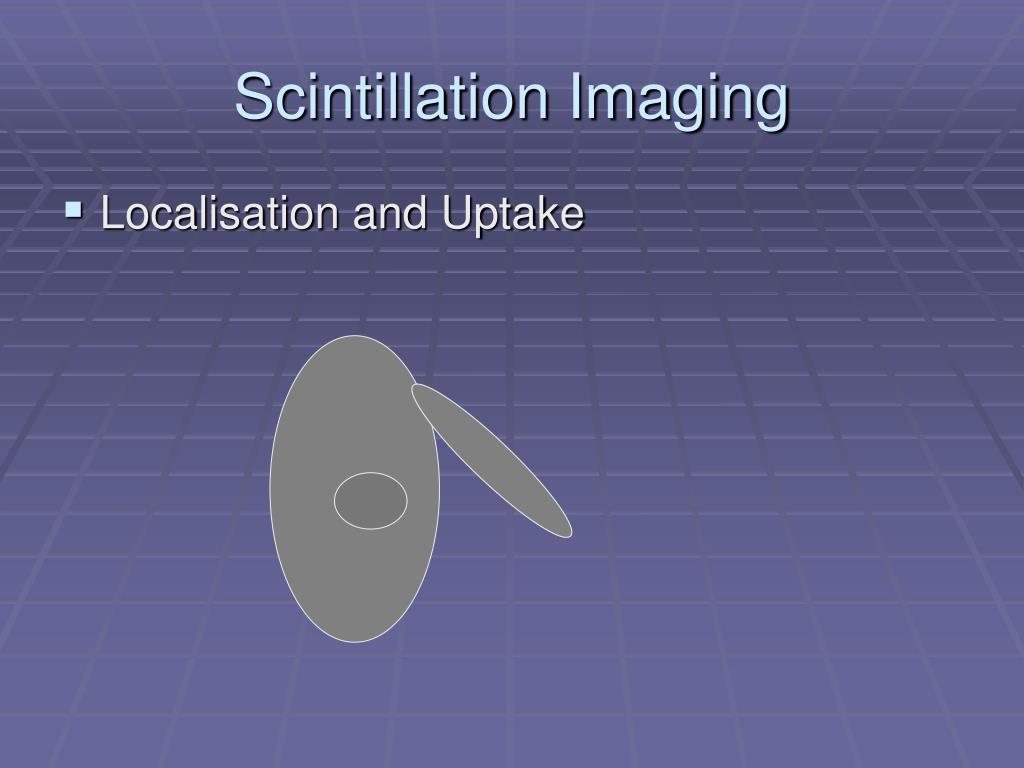 PPT - Nuclear Medicine: Planar Imaging and the Gamma Camera PowerPoint ...
