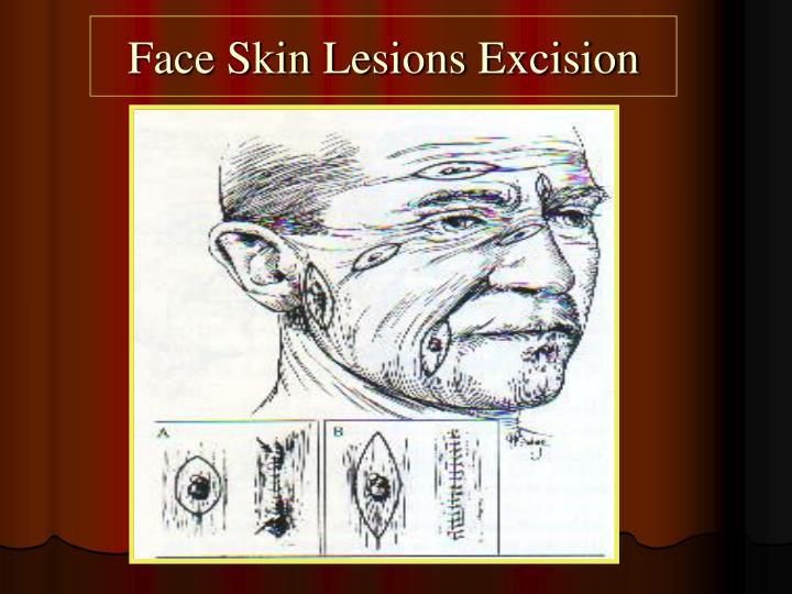 PPT - In The Name of GOD Principles of Skin Surgery Lecture For Gps ...