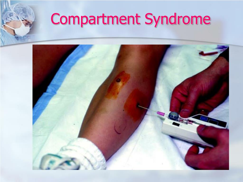 PPT - When Bad Things Happen To Good Patients: Managing The ...