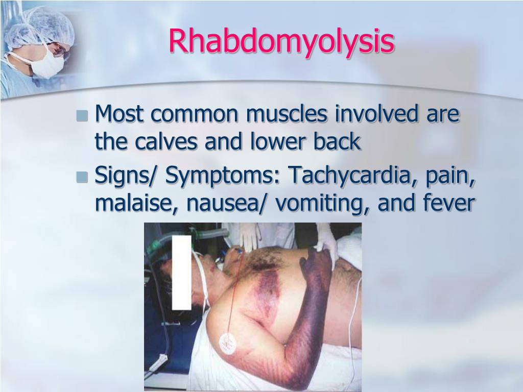 PPT - When Bad Things Happen To Good Patients: Managing The ...