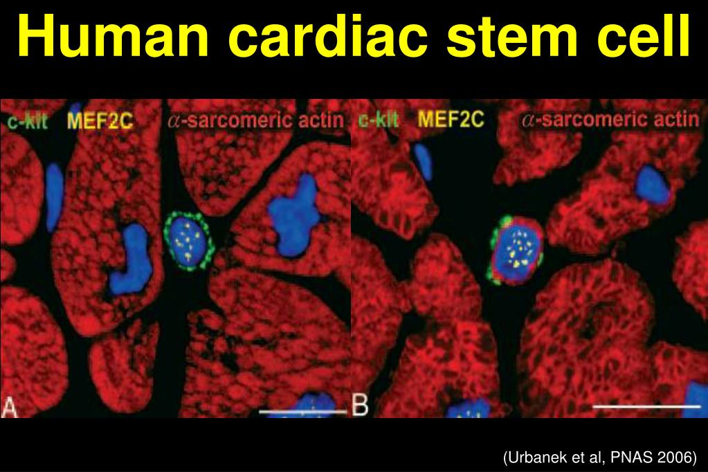 PPT - Filippo Crea Institute of Cardiology Catholic University of the ...