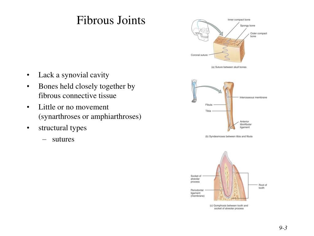 PPT - Chapter 9 Joints PowerPoint Presentation, free download - ID:3130113 PPT - Chapter 9 Joints PowerPoint Presentation, free download - ID:3130113