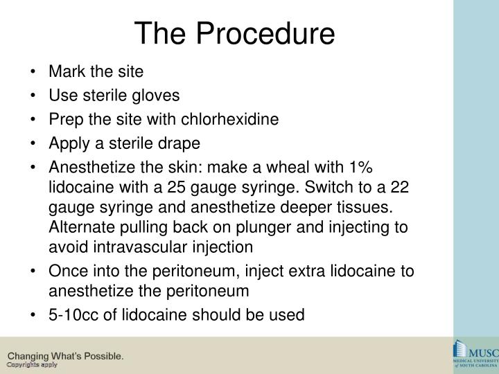 PPT - Paracentesis PowerPoint Presentation - ID:3131011