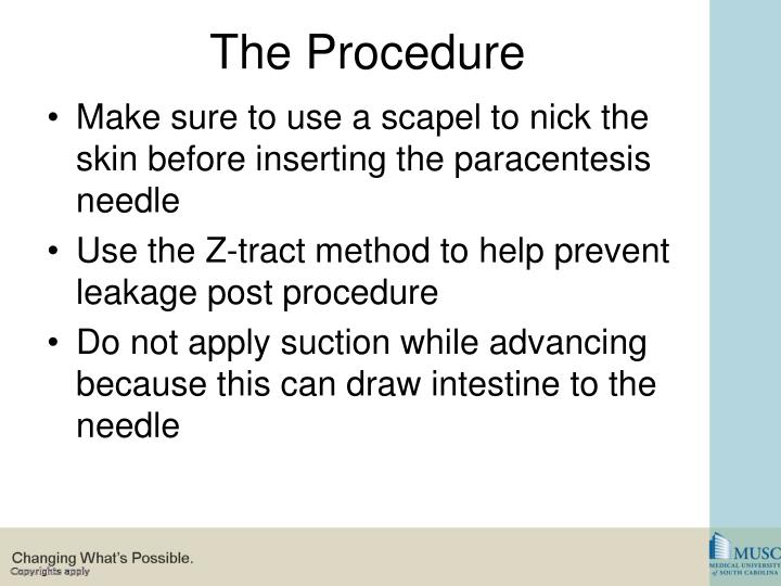 PPT - Paracentesis PowerPoint Presentation - ID:3131011