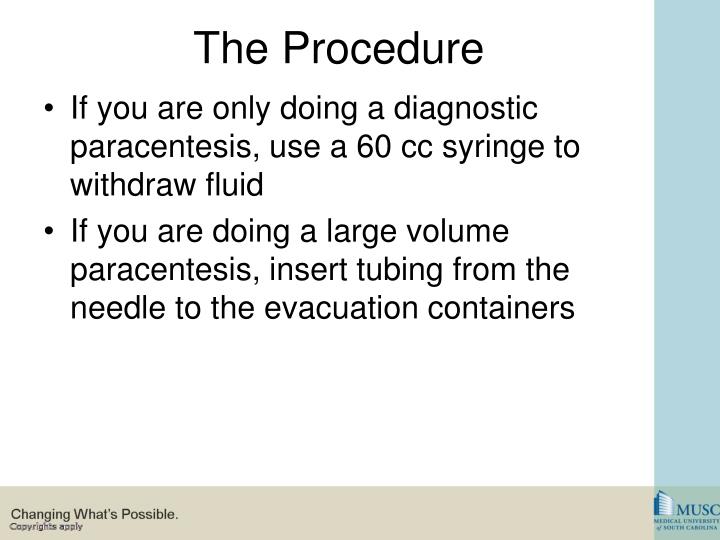PPT - Paracentesis PowerPoint Presentation - ID:3131011