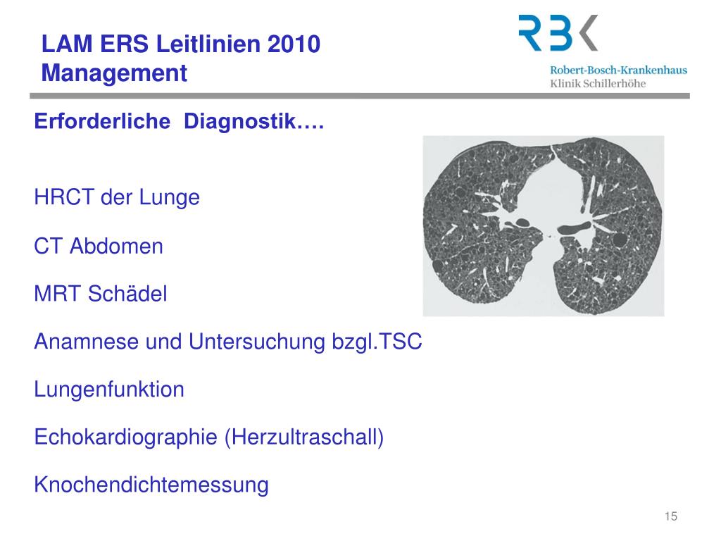 PPT - Lymphangioleiomyomatose (LAM) Physiotherapie bei LAM Stefanie ...