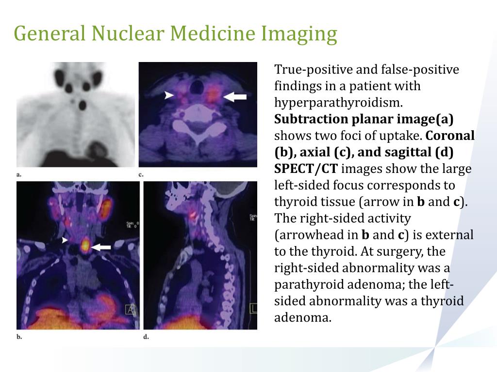 PPT - SPECT/CT IMAGING Benefits to Clinical Nuclear Medicine PowerPoint ...
