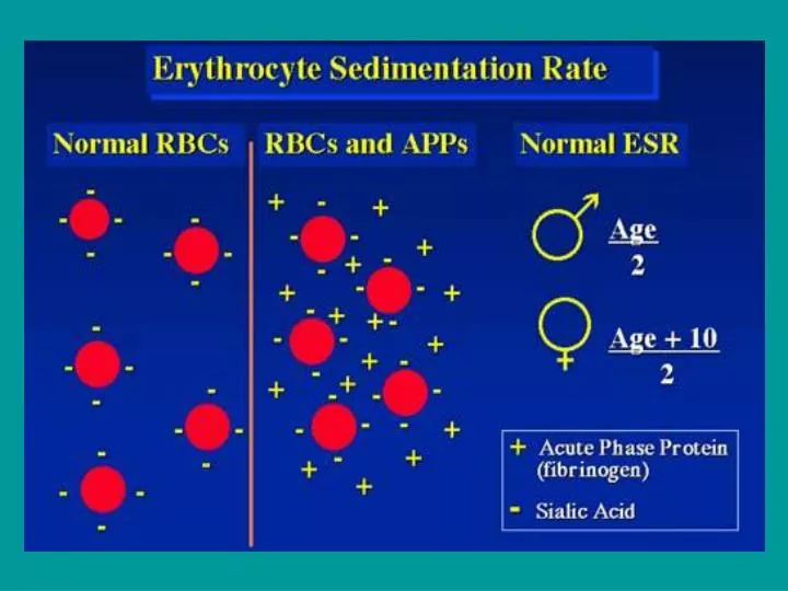 PPT - Factors Affecting the Sedimentation Rate PowerPoint Presentation ...
