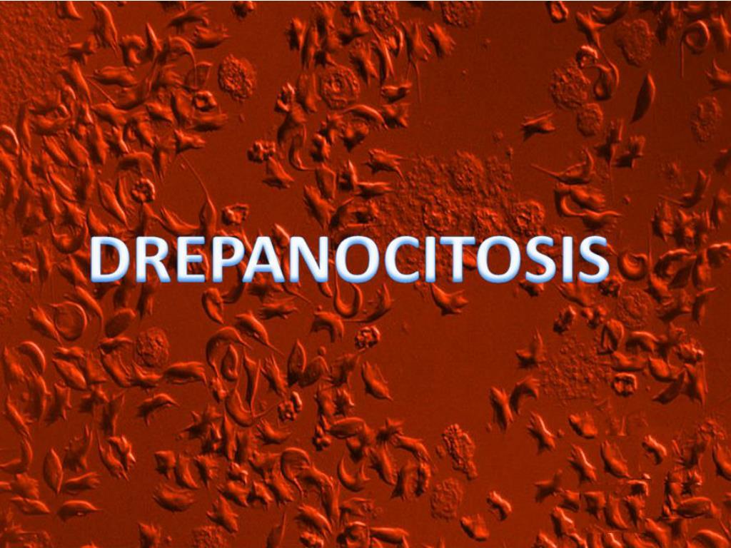PPT - ANEMIAS HEMOLÍTICAS CONGÉNITAS PowerPoint Presentation, free ...