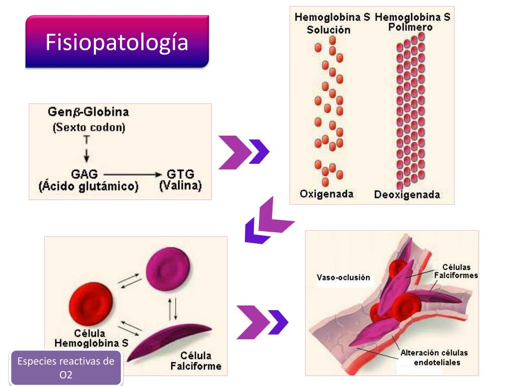 PPT - ANEMIAS HEMOLÍTICAS CONGÉNITAS PowerPoint Presentation, free ...