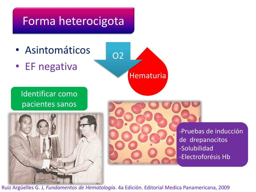 PPT - ANEMIAS HEMOLÍTICAS CONGÉNITAS PowerPoint Presentation, free ...