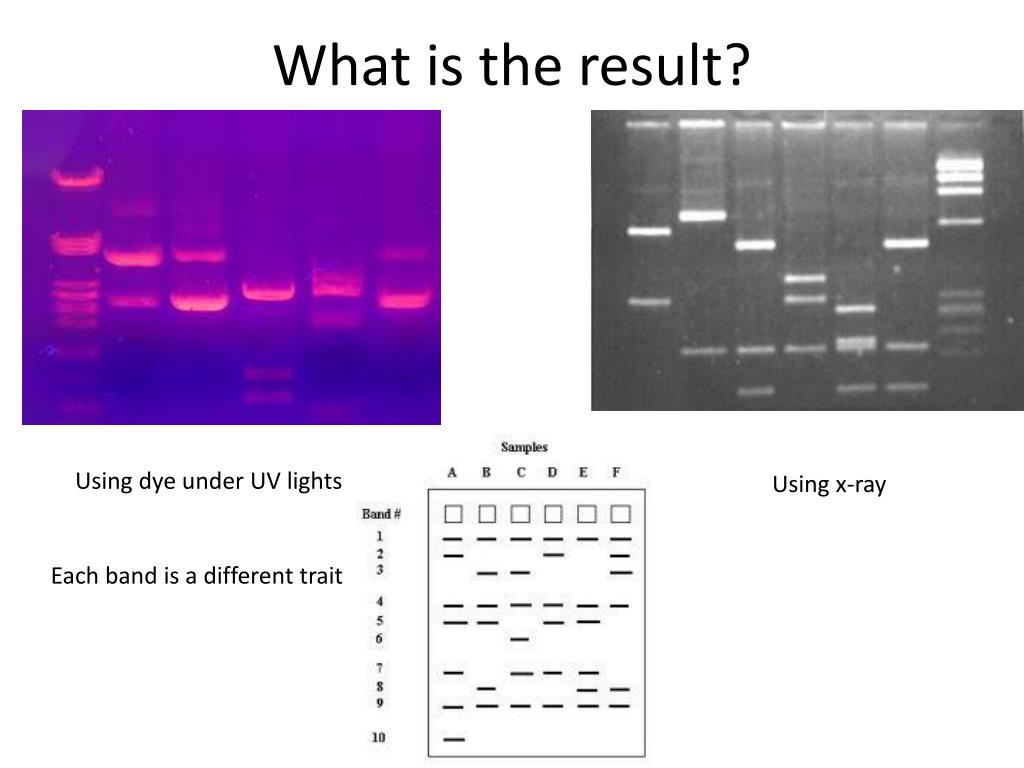 PPT - Gel Electrophoresis and DNA Fingerprinting PowerPoint ...