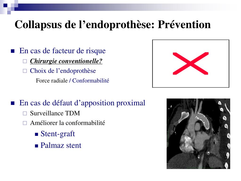 PPT - L Canaud, Pierre Alric, Ch Mary-Ané CHU de Montpellier PowerPoint ...