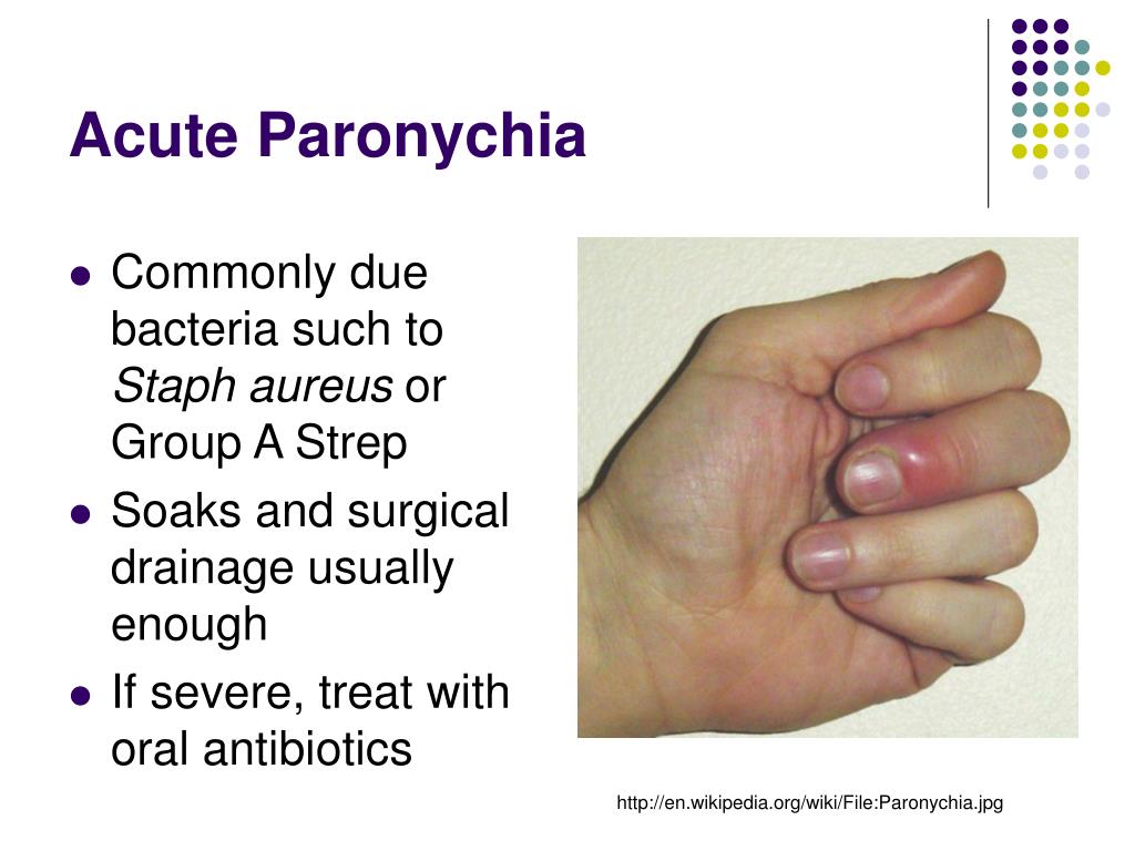 PPT - Soft Tissue & Musculoskeletal Infections in the Primary Care ...