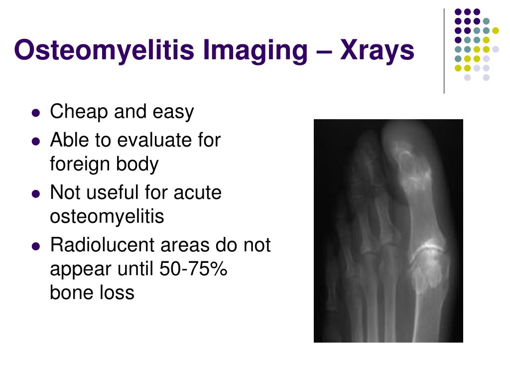 PPT - Soft Tissue & Musculoskeletal Infections in the Primary Care ...