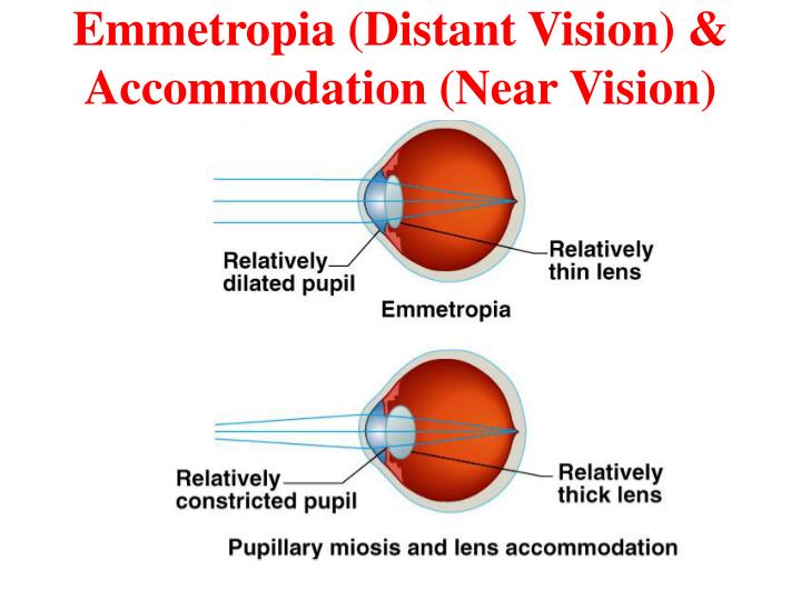 PPT - EYE PowerPoint Presentation - ID:3148018