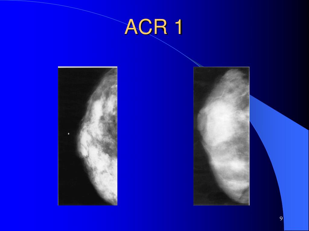 PPT - Risque Radiologique (Dr POUGET- Dr ABOUN) PowerPoint Presentation ...
