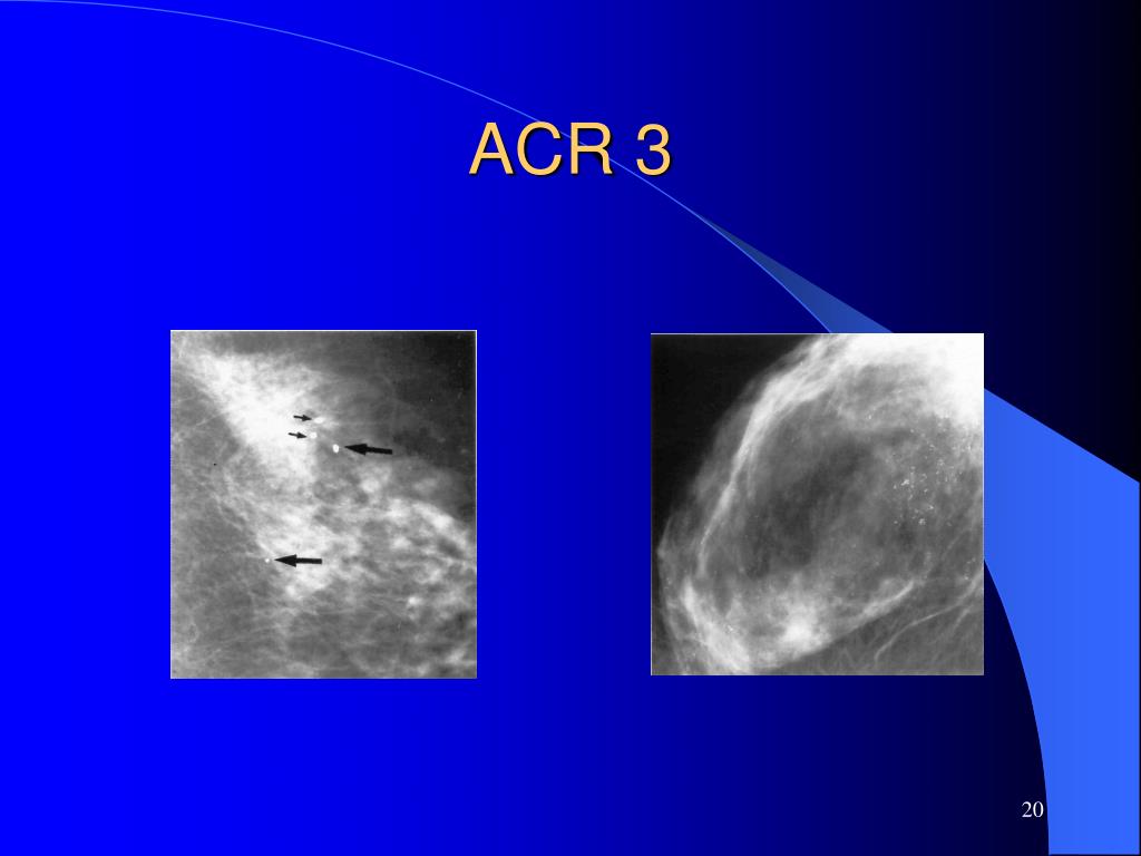 PPT - Risque Radiologique (Dr POUGET- Dr ABOUN) PowerPoint Presentation ...