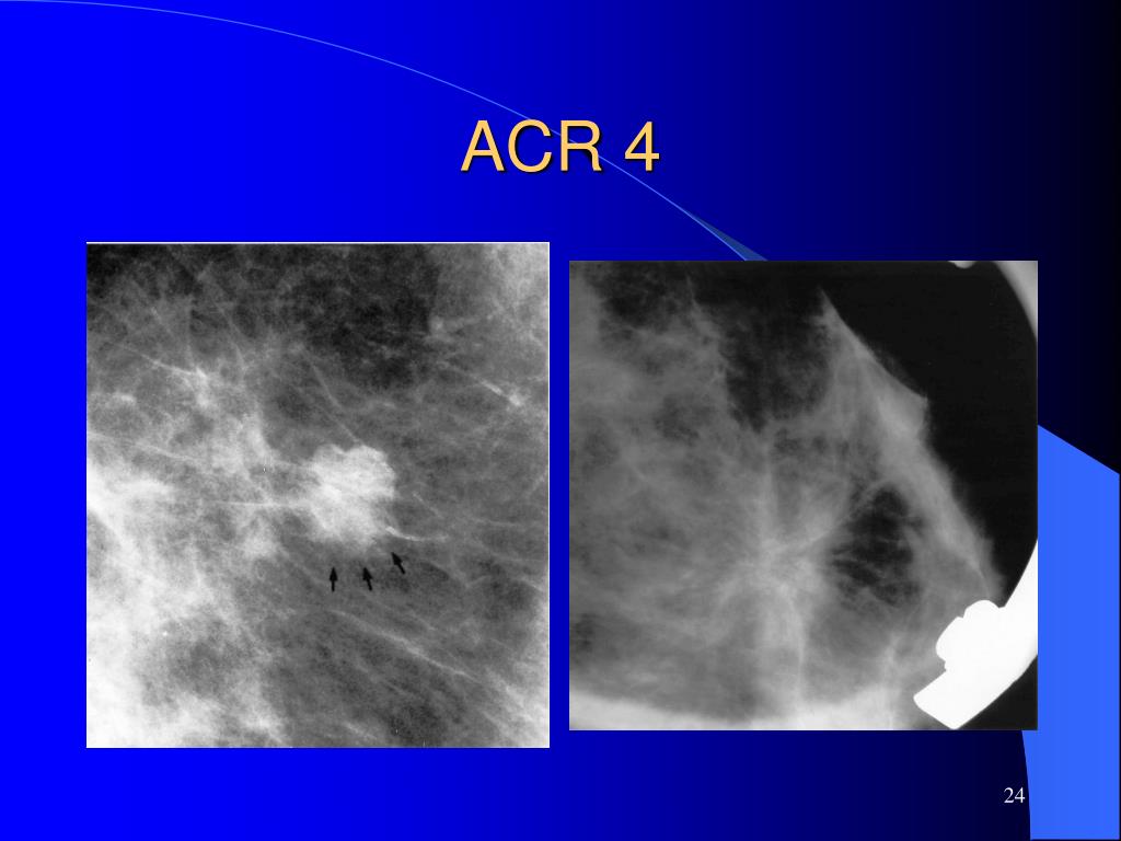PPT - Risque Radiologique (Dr POUGET- Dr ABOUN) PowerPoint Presentation ...