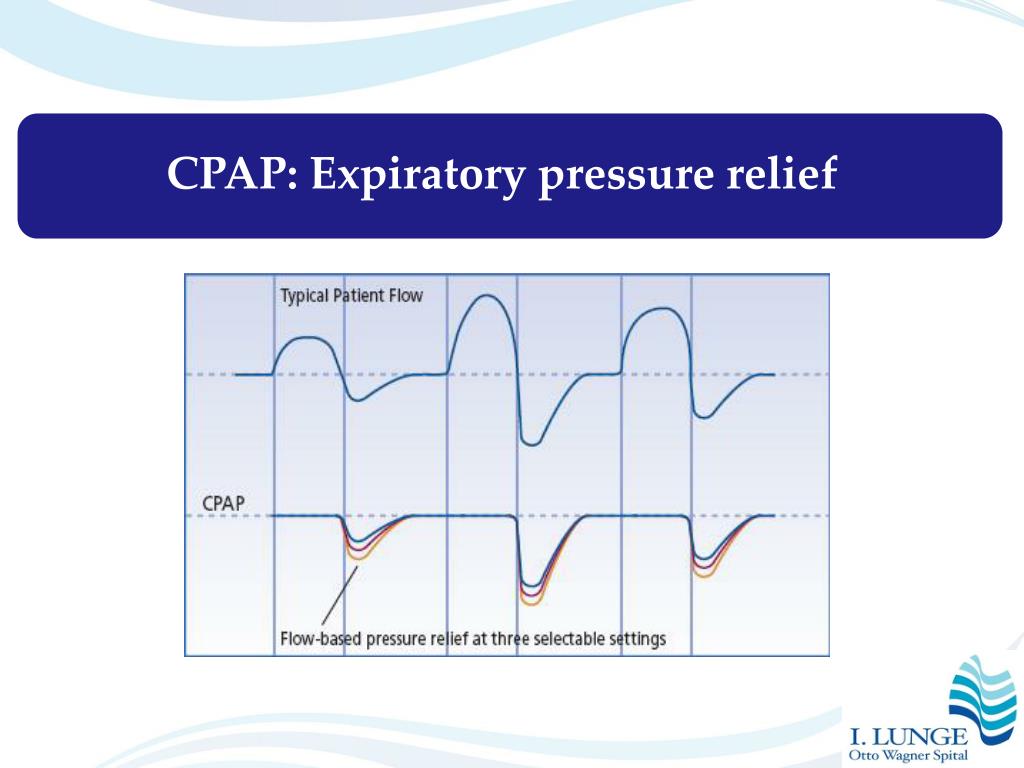 PPT - Obstructive Sleep Apnea Medical Treatment including nPAP ...