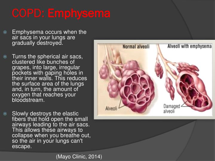 PPT - Chronic obstructive pulmonary disease (COPD) PowerPoint ...