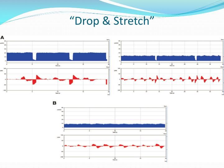 PPT - Airway Pressure Release Ventilation APRV PowerPoint Presentation ...