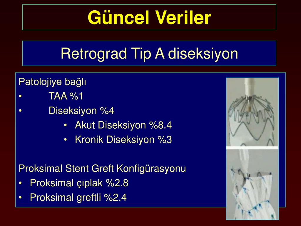 PPT - Torakal Aort Hastalıkları Endovasküler Tedavisinde Güncel Durum ...