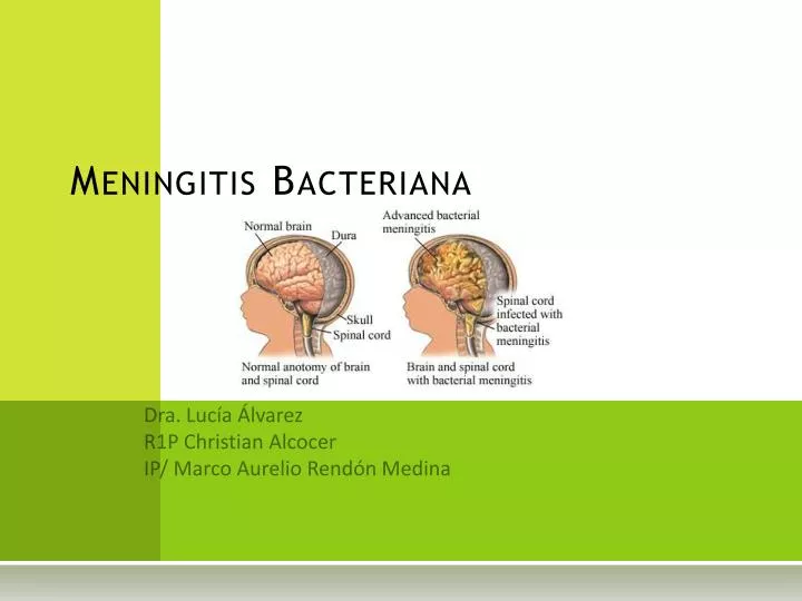 PPT - Meningitis Bacteriana PowerPoint Presentation, free download - ID ...