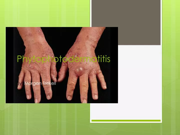 PPT - Phytophotodermatitis PowerPoint Presentation, free download - ID ...
