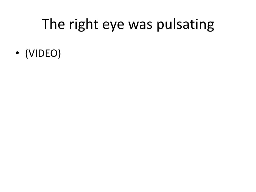PPT - Pulsatile proptosis from sphenoid wing hypoplasia ...