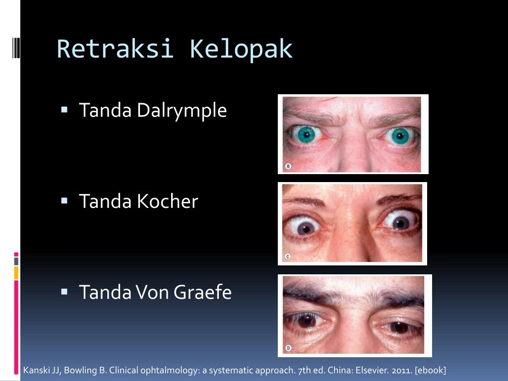 PPT - Dwi Wicaksono Jody Felizio PowerPoint Presentation, free download ...