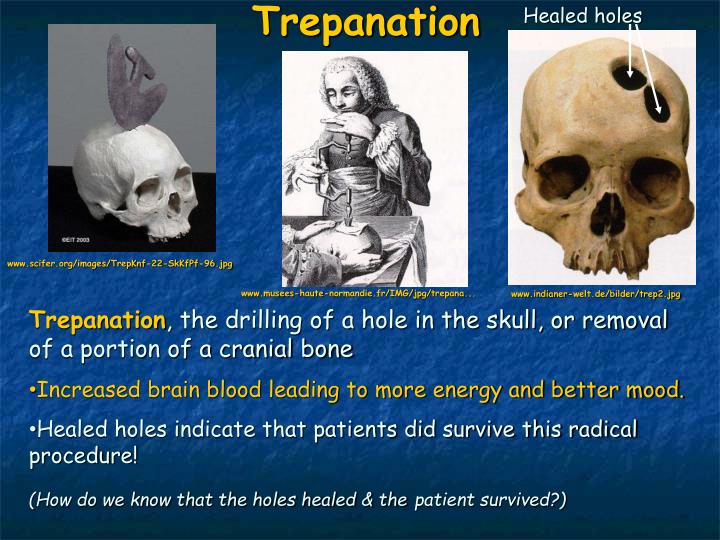 PPT - The History of Anatomy PowerPoint Presentation - ID:3196242
