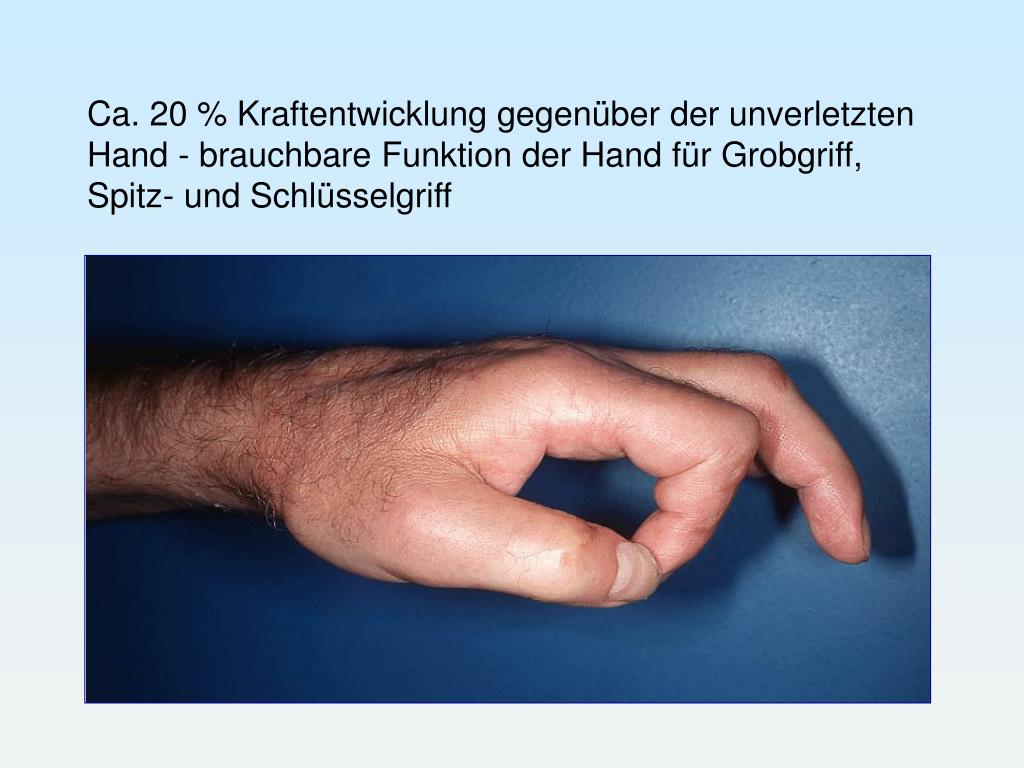 PPT - Berufsgenossenschaftliche Kliniken Bergmannstrost Halle ...