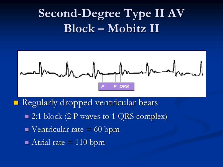 PPT - Pacemaker General Concepts PowerPoint Presentation - ID:3197620